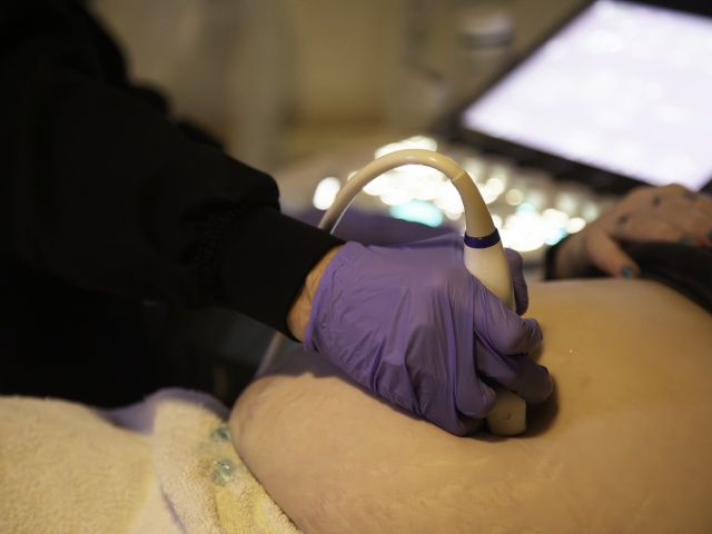 Maternal-Fetal Medicine | University of Vermont Health