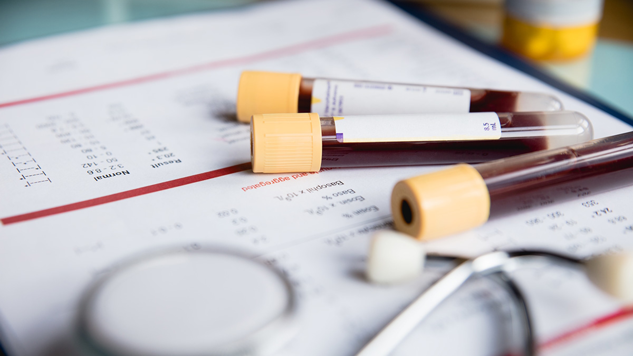 Medical Records & Tests Results | University of Vermont Health
