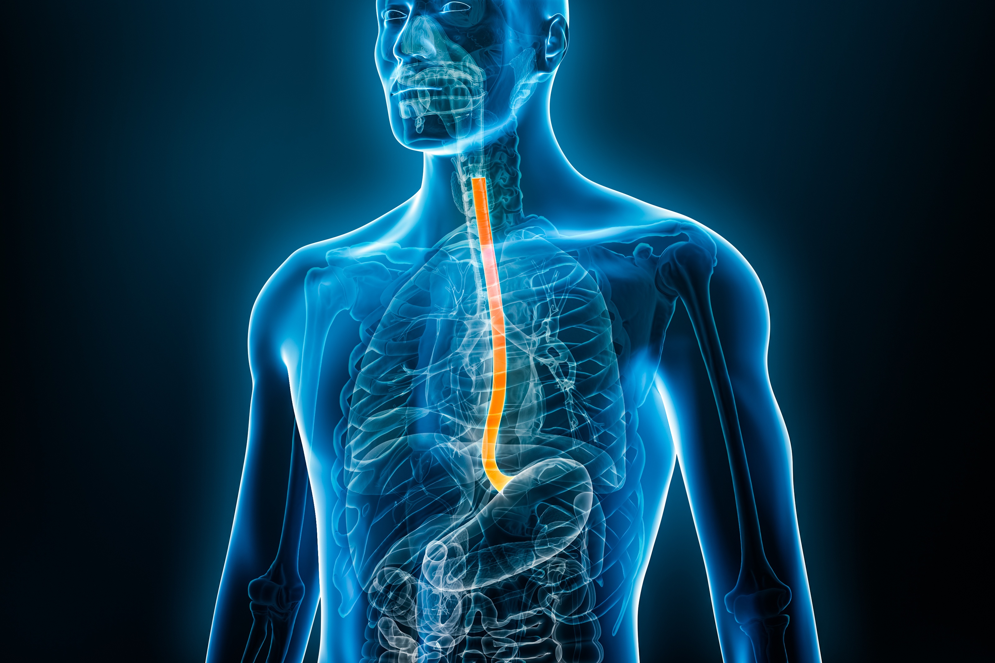 Barrett’s Esophagus | University of Vermont Health